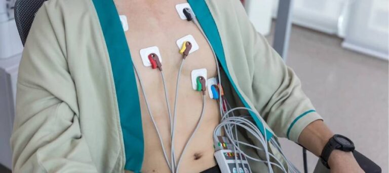 Holter Monitoring by Cardiologist Dr. Bharat Agarwal